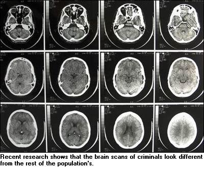 INT: Brain scans reveal the criminal mind